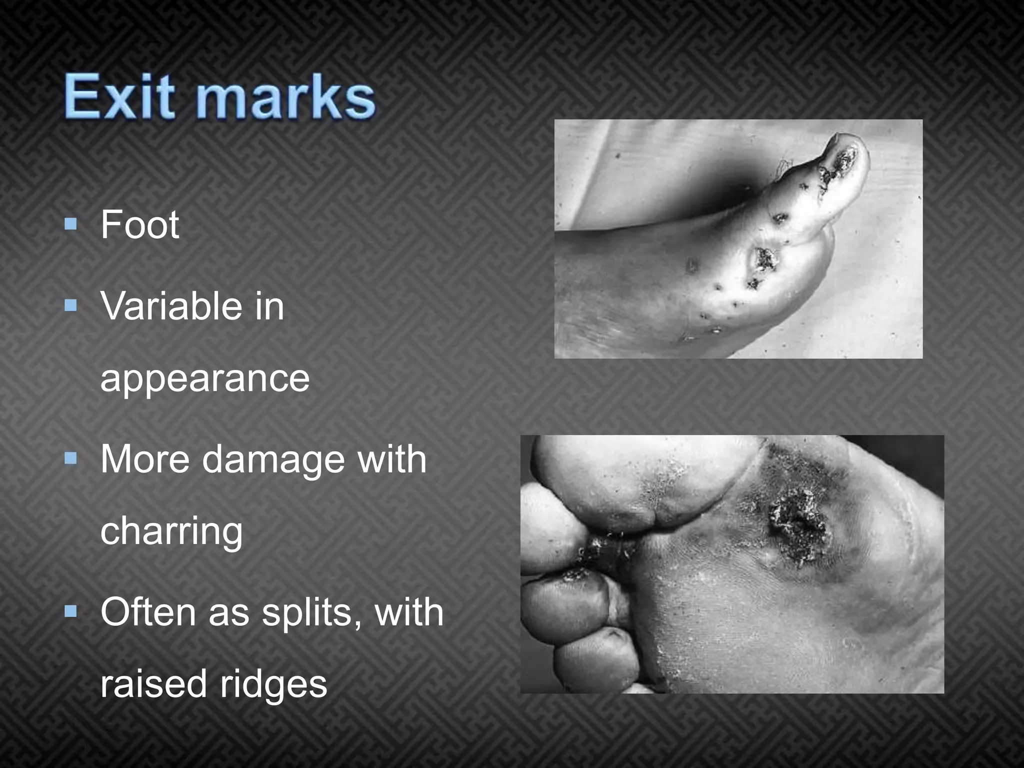 Electrical injuries Dr Ashutosh | PPTX