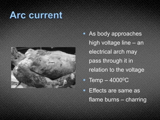 Electrical injuries Dr Ashutosh | PPTX