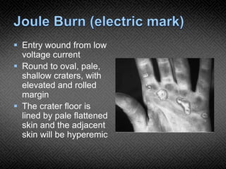 Electrical injuries Dr Ashutosh | PPTX | First Aid | Injuries