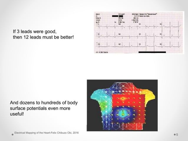 Electrical Mapping Of The Heart Ppt
