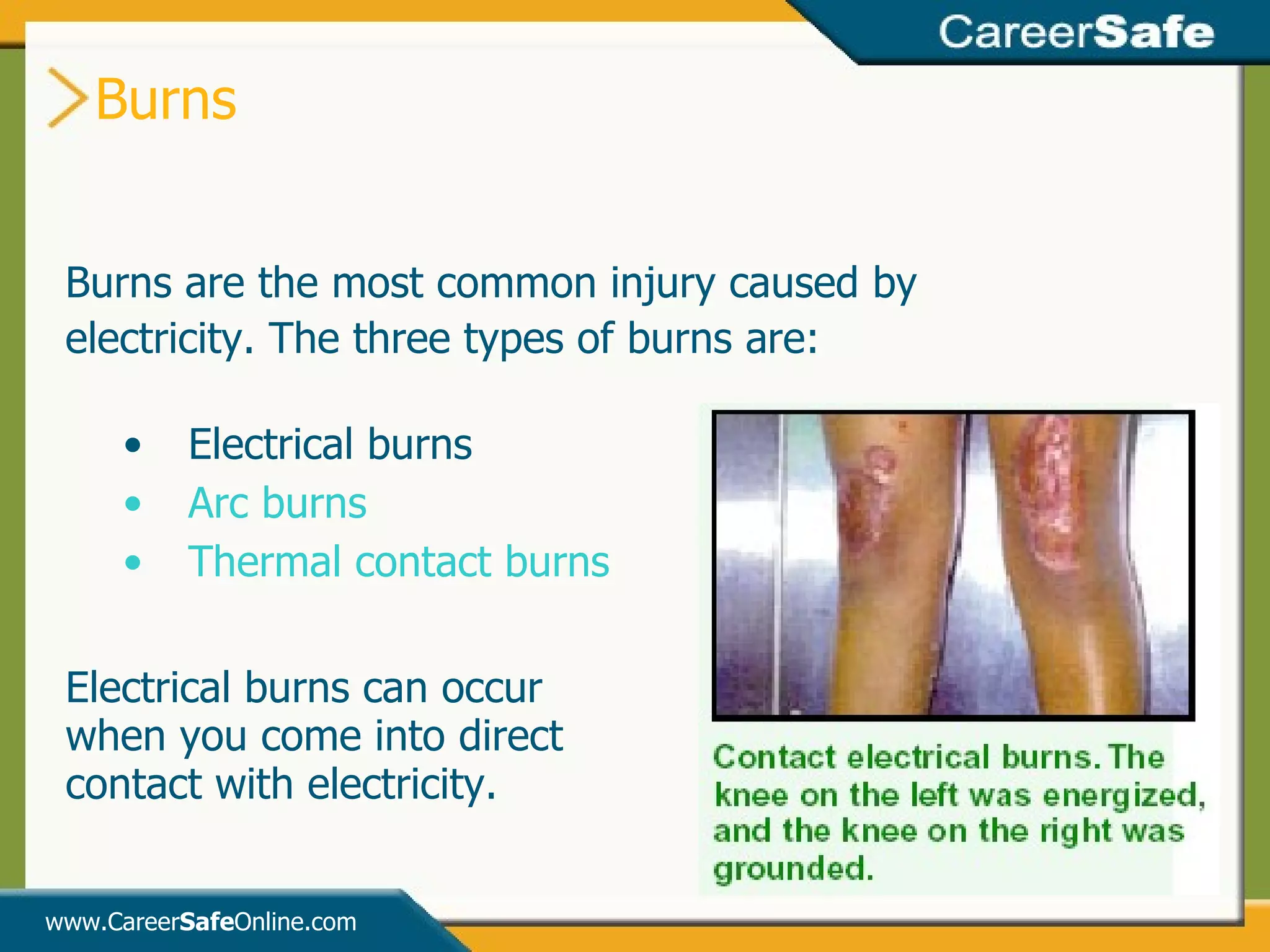 Electrical safety | PPT