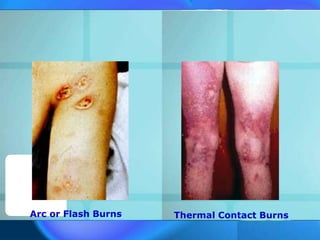 Electrical Safety.ppt