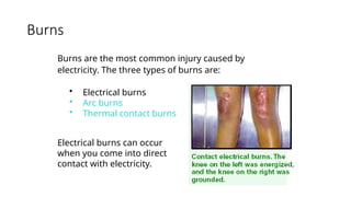 "Electrical Safety Awareness: Preventing Accidents at Work and Home" | PPTX