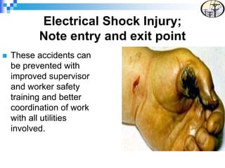 Electrical safety13 | PPT