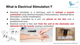 How to use Electrical Stimulation for Faster Hand Recovery After Stroke ...
