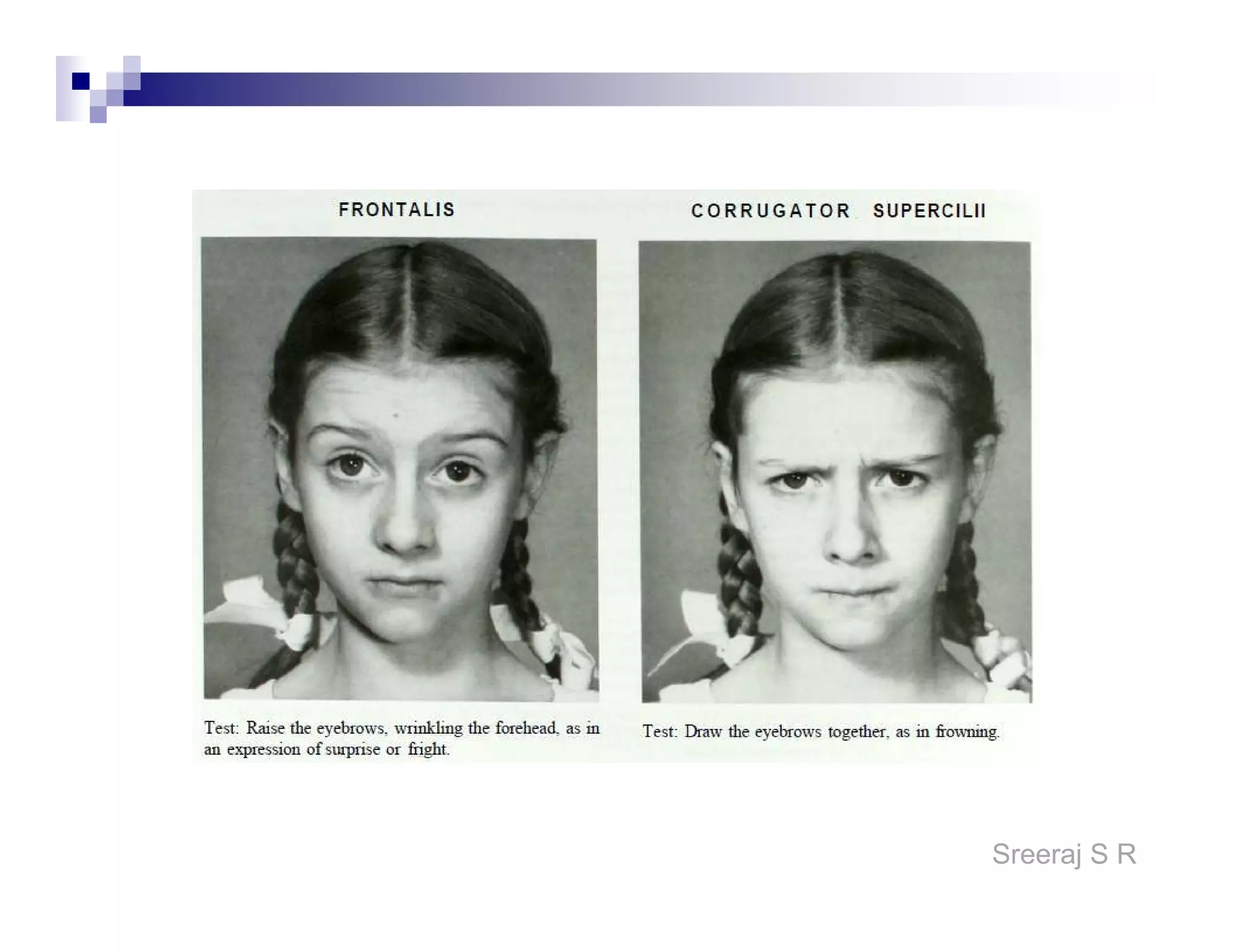 Electrical stimulation motor points and application | PDF