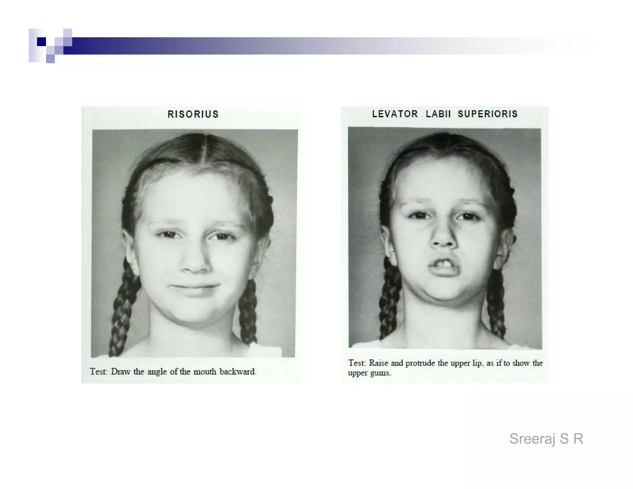 Electrical stimulation motor points and application | PDF