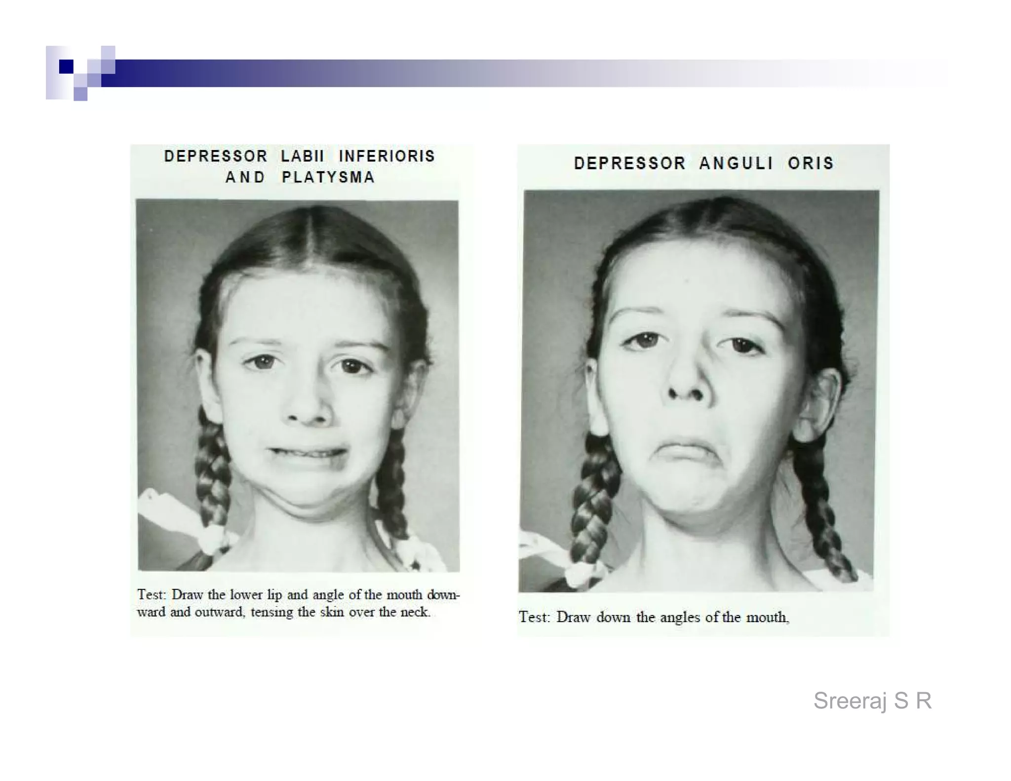 Electrical stimulation motor points and application | PDF