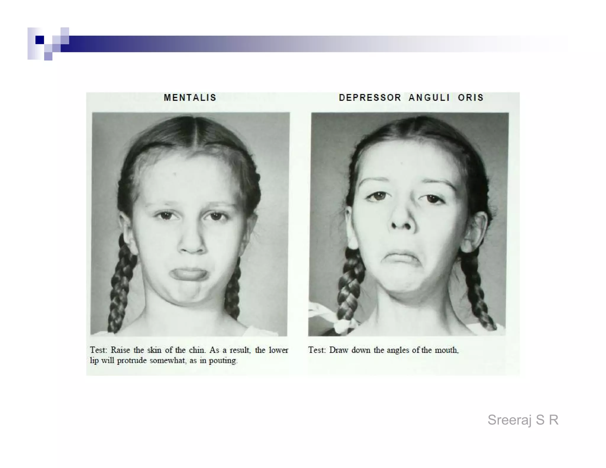 Electrical stimulation motor points and application | PDF