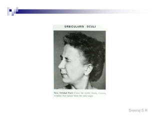 Electrical stimulation motor points and application | PDF