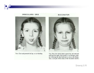 Electrical stimulation motor points and application | PDF