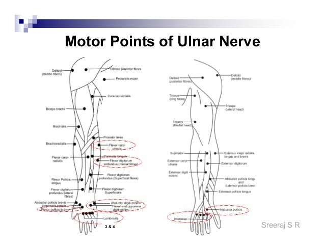 Electrical stimulation motor points and application