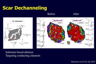Electrical storm timing and approach for ablation | PPT