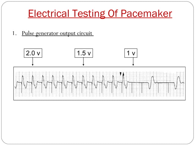 Electrical testing of pacemaker | PPT