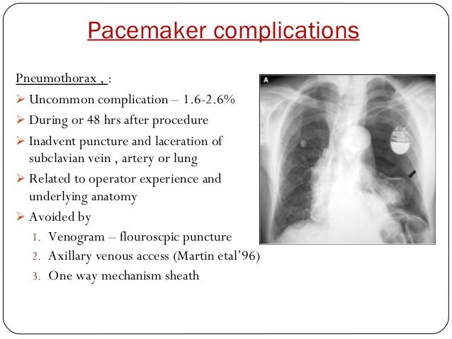Electrical testing of pacemaker