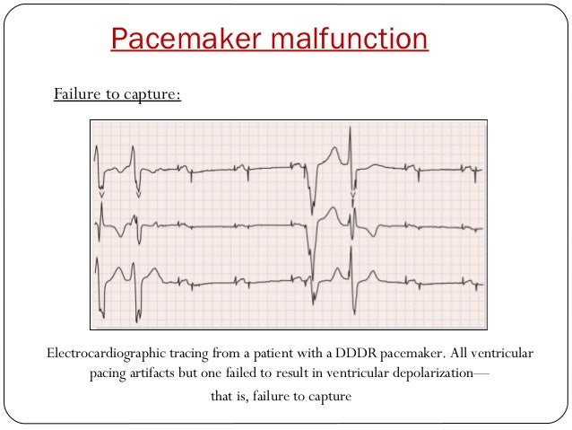Electrical testing of pacemaker