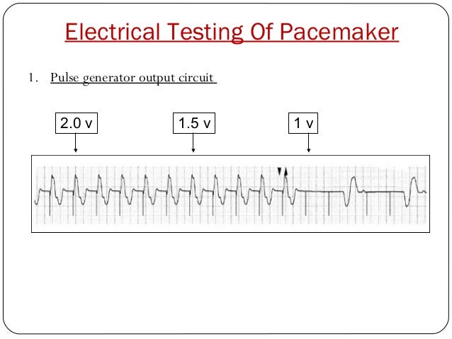 Electrical testing of pacemaker