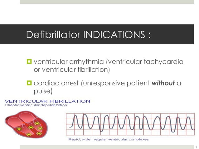Electrical therapies in cpr | PPTX