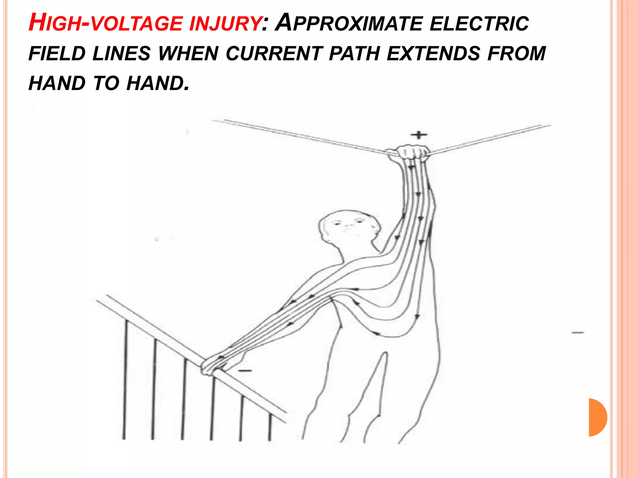 Electric burn | PPTX