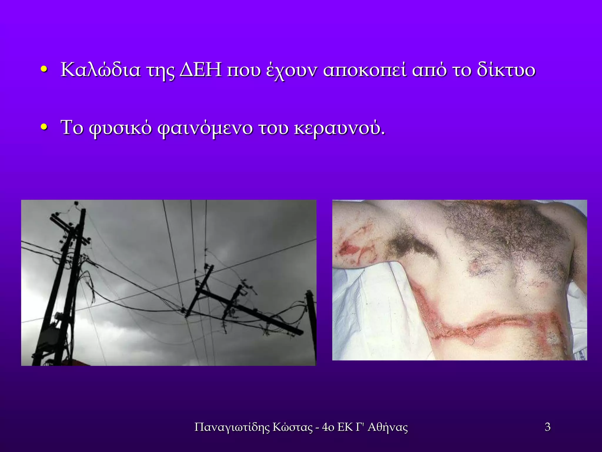 Ηλεκτρικά εγκαύματα - Ηλεκτροπληξία | PPTX