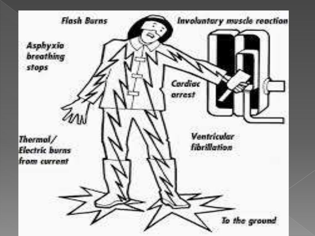 Electric shock and their first aid