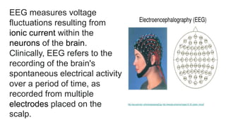 Electro-Encephalography.pptx