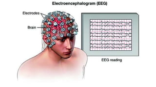 Electro-Encephalography.pptx