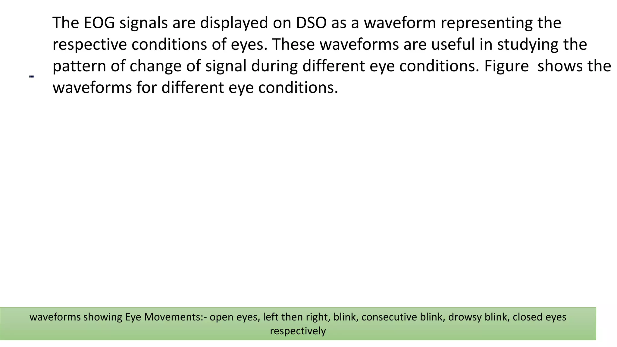 Electro oculography, EOG -a detailed medical information| all about EOG ...