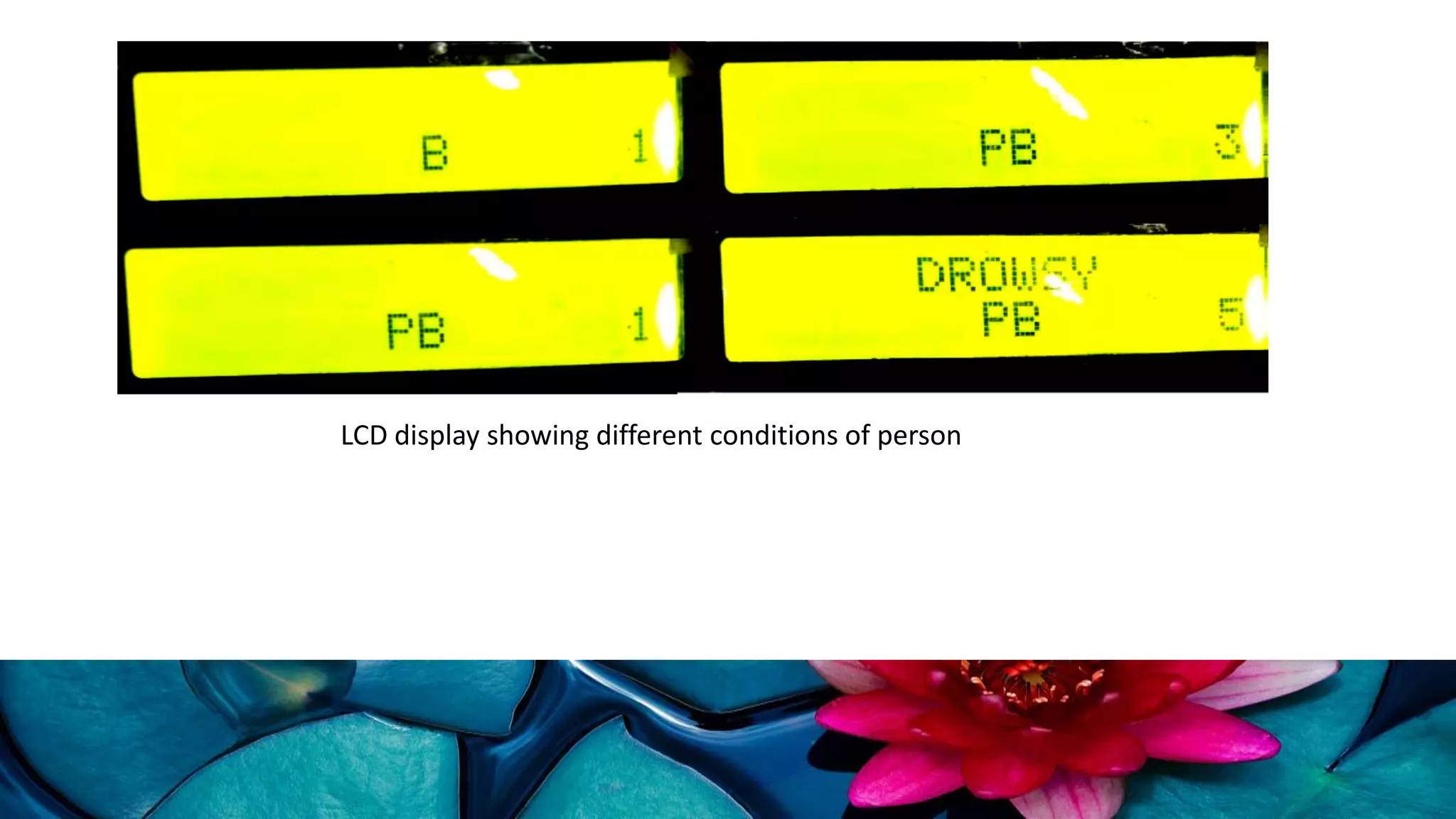 Electro oculography, EOG -a detailed medical information| all about EOG ...