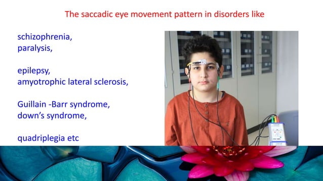 Electro oculography, EOG -a detailed medical information| all about EOG ...