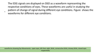 Electro oculography, EOG -a detailed medical information| all about EOG ...