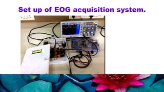 Electro oculography, EOG -a detailed medical information| all about EOG ...