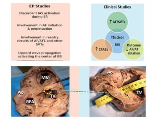 Electro anatomy.ppt