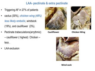 Electro anatomy.ppt