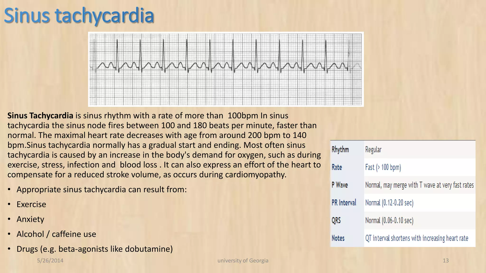 Electrocardiogram ECG or EKG | PPTX