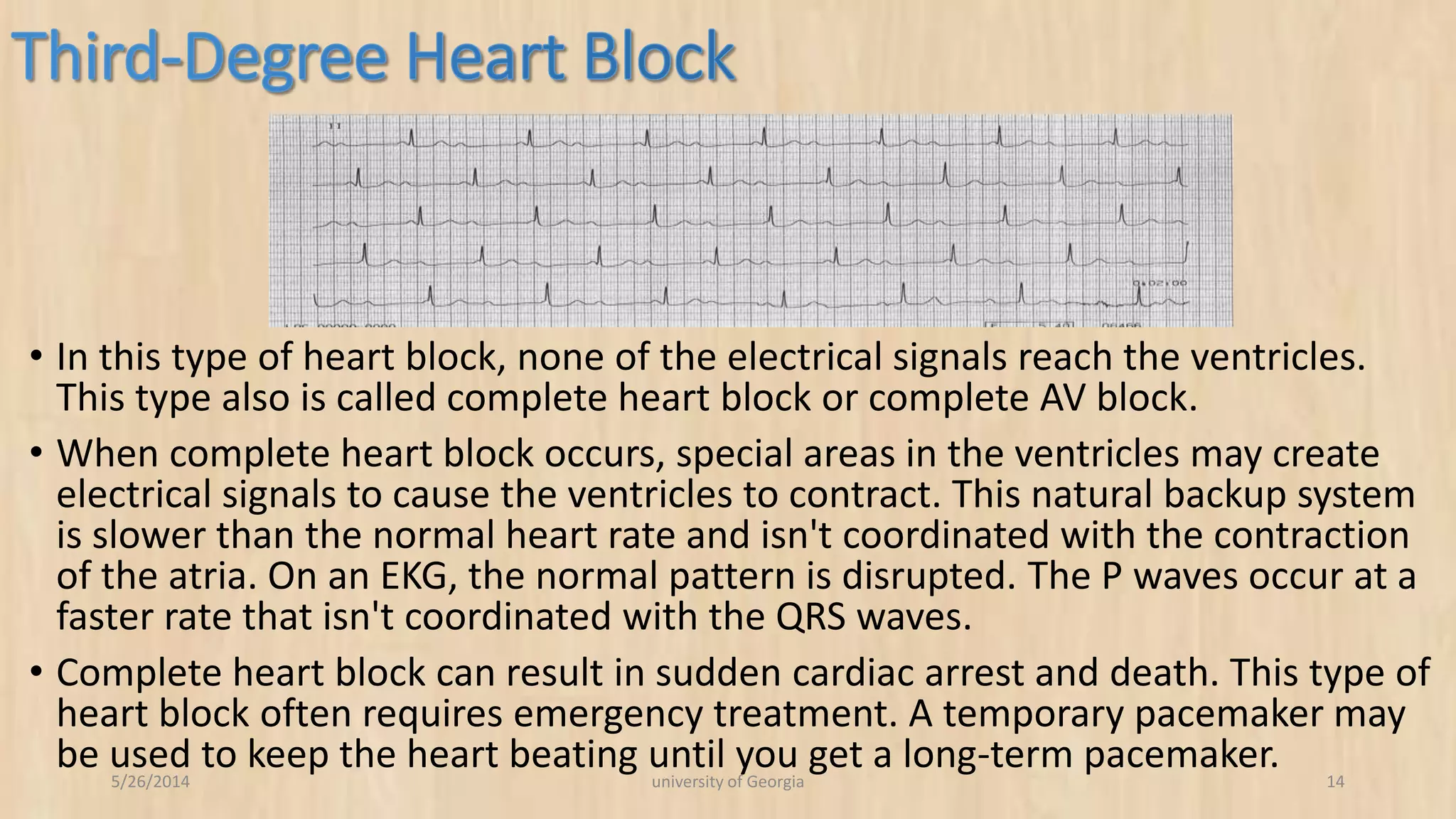 Electrocardiogram ECG or EKG | PPTX