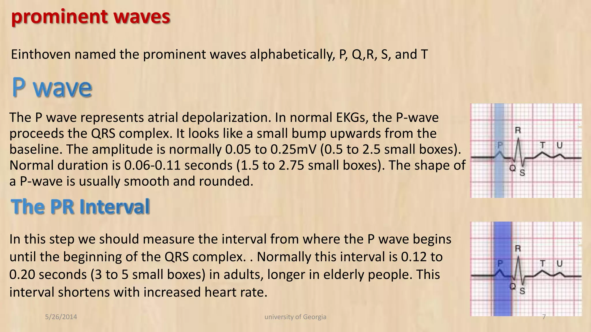 Electrocardiogram ECG or EKG | PPTX