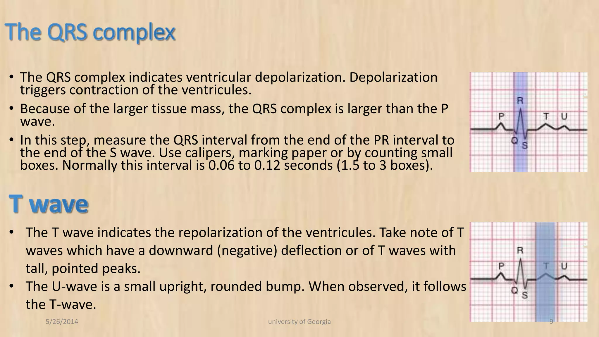 Electrocardiogram ECG or EKG | PPTX
