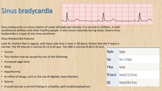 Electrocardiogram ECG or EKG | PPTX