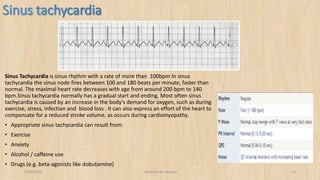 Electrocardiogram ECG or EKG | PPTX