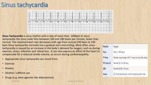Electrocardiogram ECG or EKG | PPTX