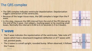 Electrocardiogram ECG or EKG | PPT