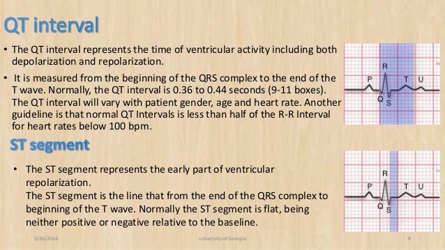 Electrocardiogram ECG or EKG