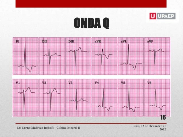 Electrocardiografía
