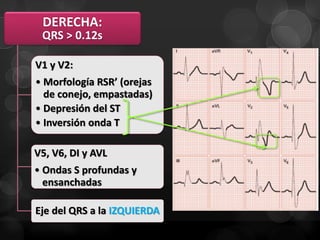 Electrocardiografía clínica | PPT