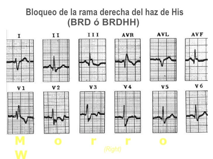 Electrocardiografia ekg-