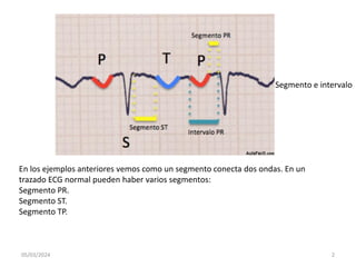 ELECTROCARDIOGRAFIA BASICA Tercera Parte | PDF