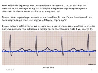 ELECTROCARDIOGRAFIA BASICA Tercera Parte | PDF