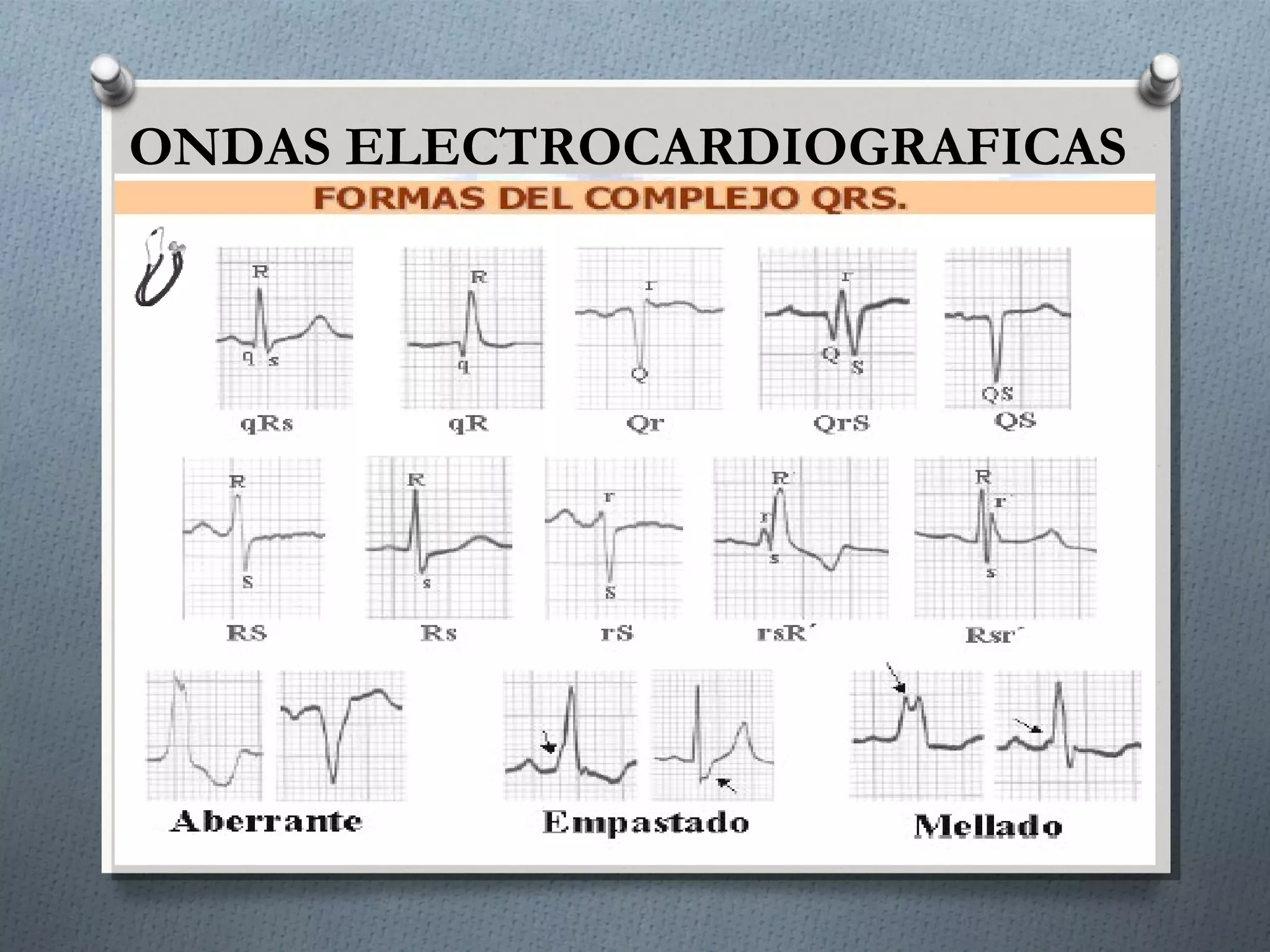 Electrocardiografia basica y signos de alarma ( Autores Lic.Ojeda David ...