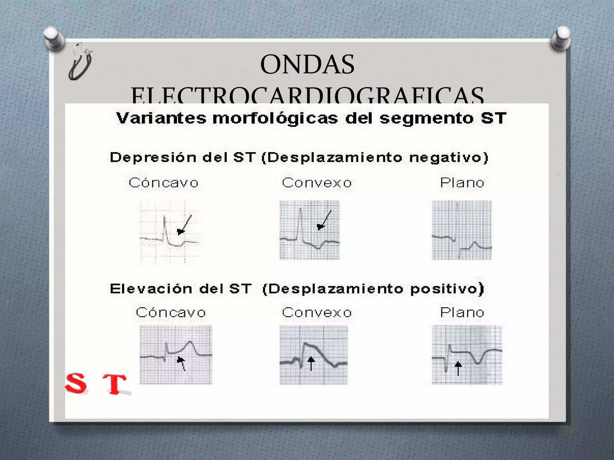 Electrocardiografia basica y signos de alarma ( Autores Lic.Ojeda David ...